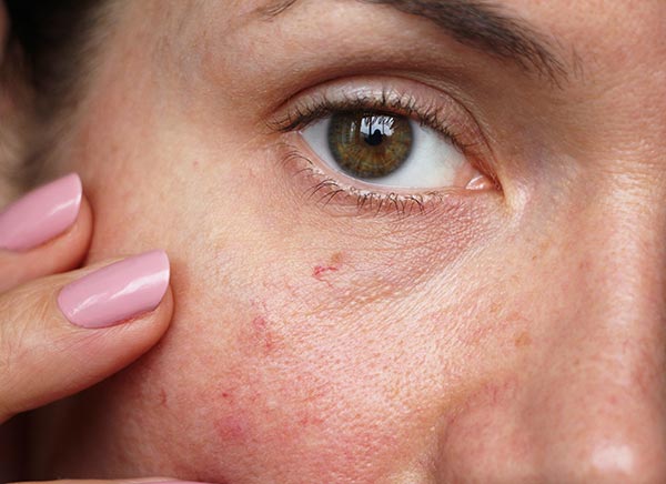 Dermatology Clinic - Dermal Clinic | Beauty treatments in Edinburgh